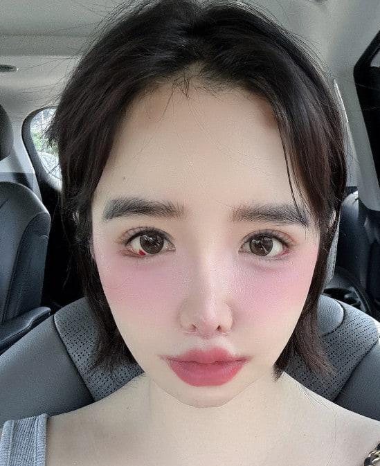 박봄, 드라이브 중 충혈된 눈 셀카 공개